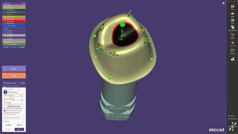 DentalCAD 3.3 Chemnitz - exocad