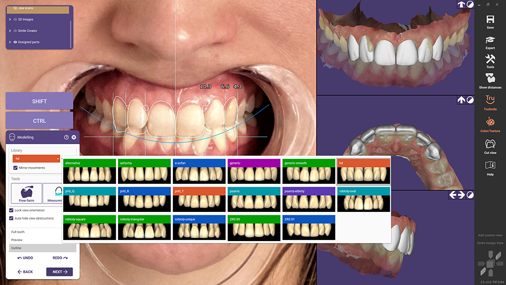 Smile Creator - exocad