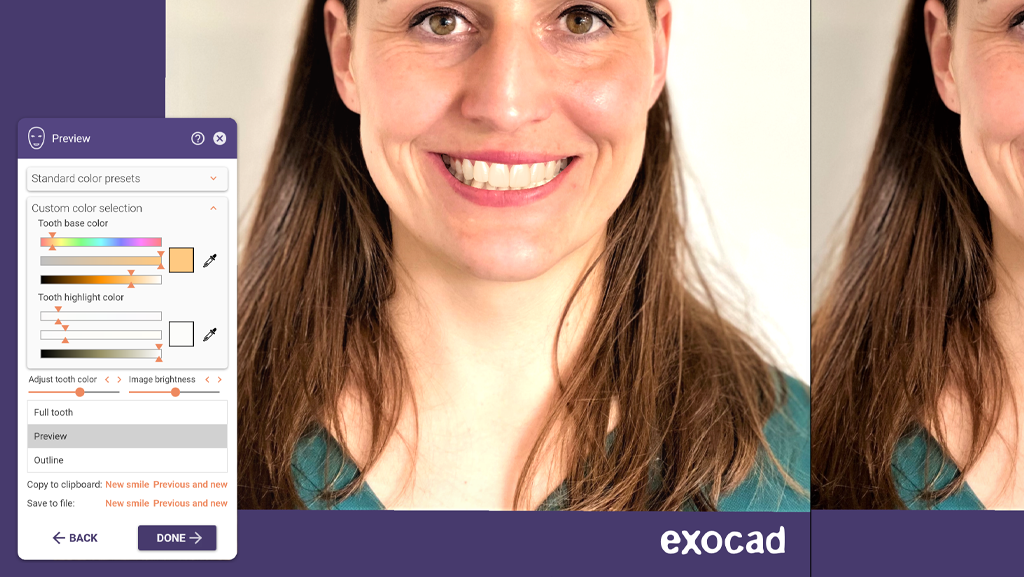 Smile Creator - exocad