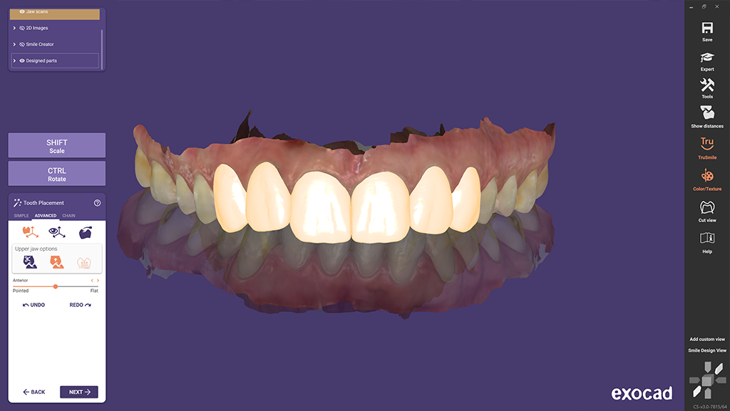 Exocad Viewer Exocad DentalCAD – Smart Optics