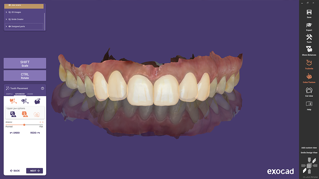 Smile Creator - exocad