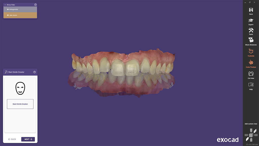 Smile Creator - exocad