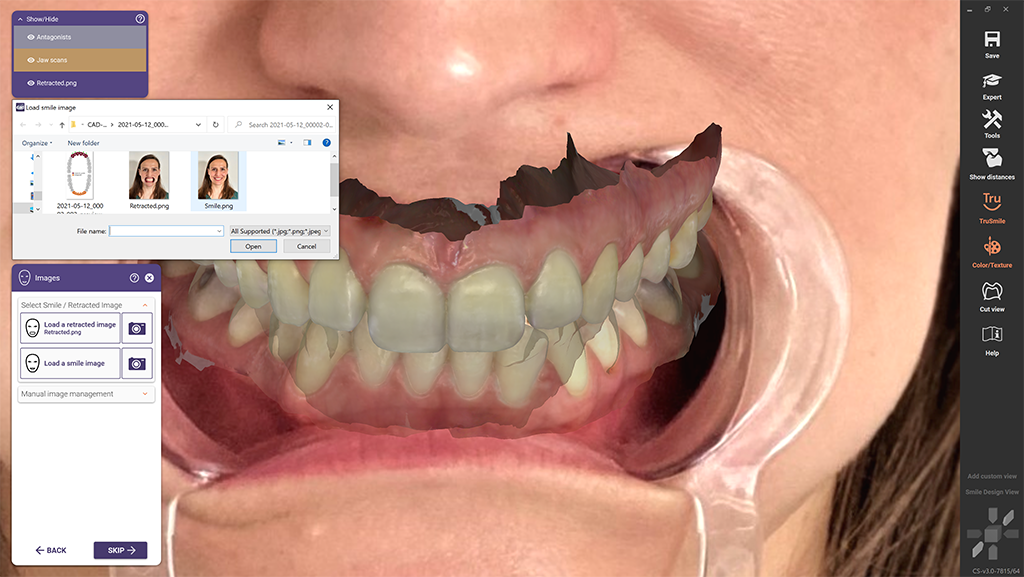 Smile Creator - exocad