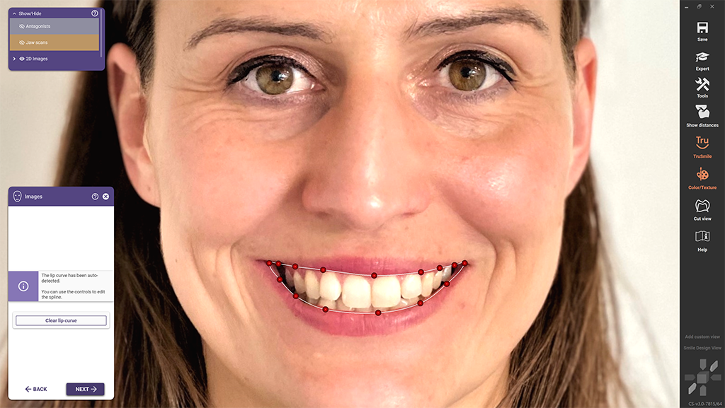 Smile Creator - exocad