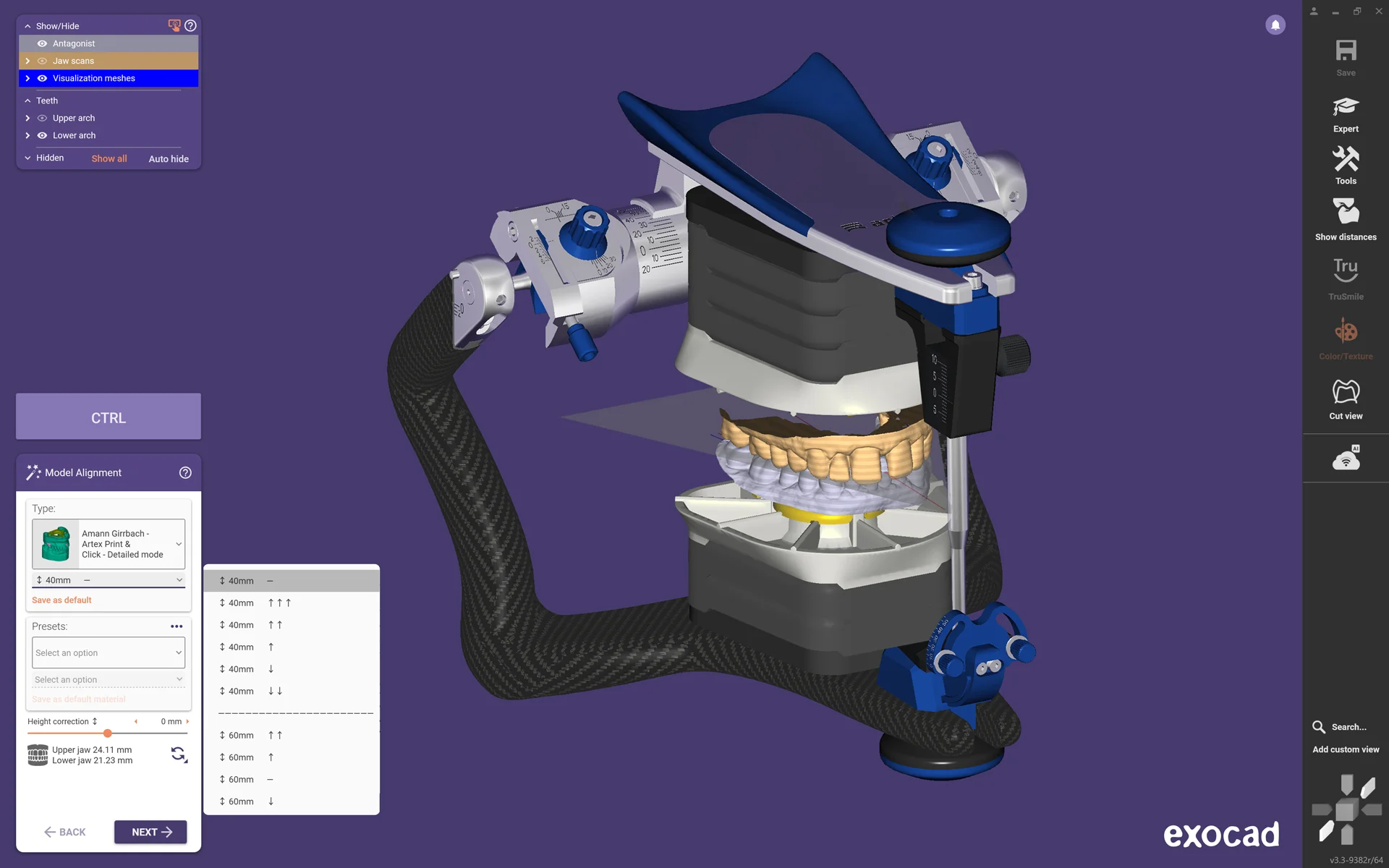 DentalCAD 3.3 Chemnitz - exocad