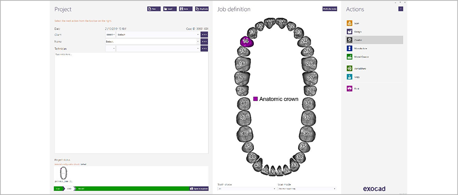 PARTNER NEWS: Coherent and exocad Collaborate to Offer Improved ...